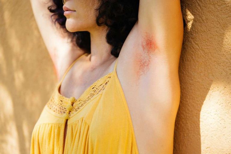 Douleur au muscle sous l’aisselle : quelles sont les causes et que ...